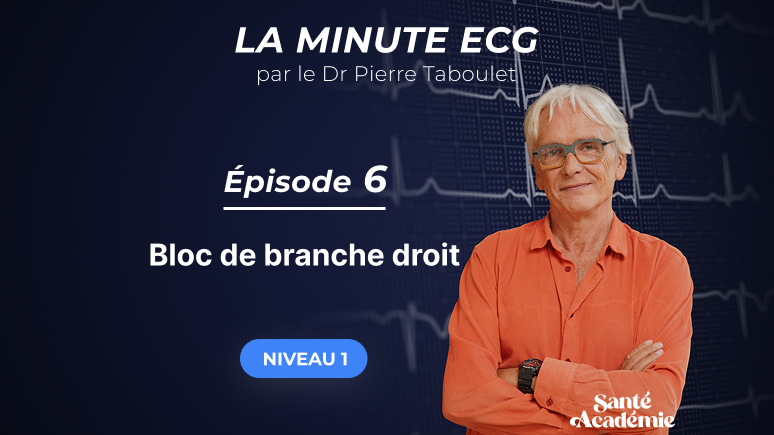 La minute ECG : Bloc de branche droit ? - Regardez le replay gratuit ...
